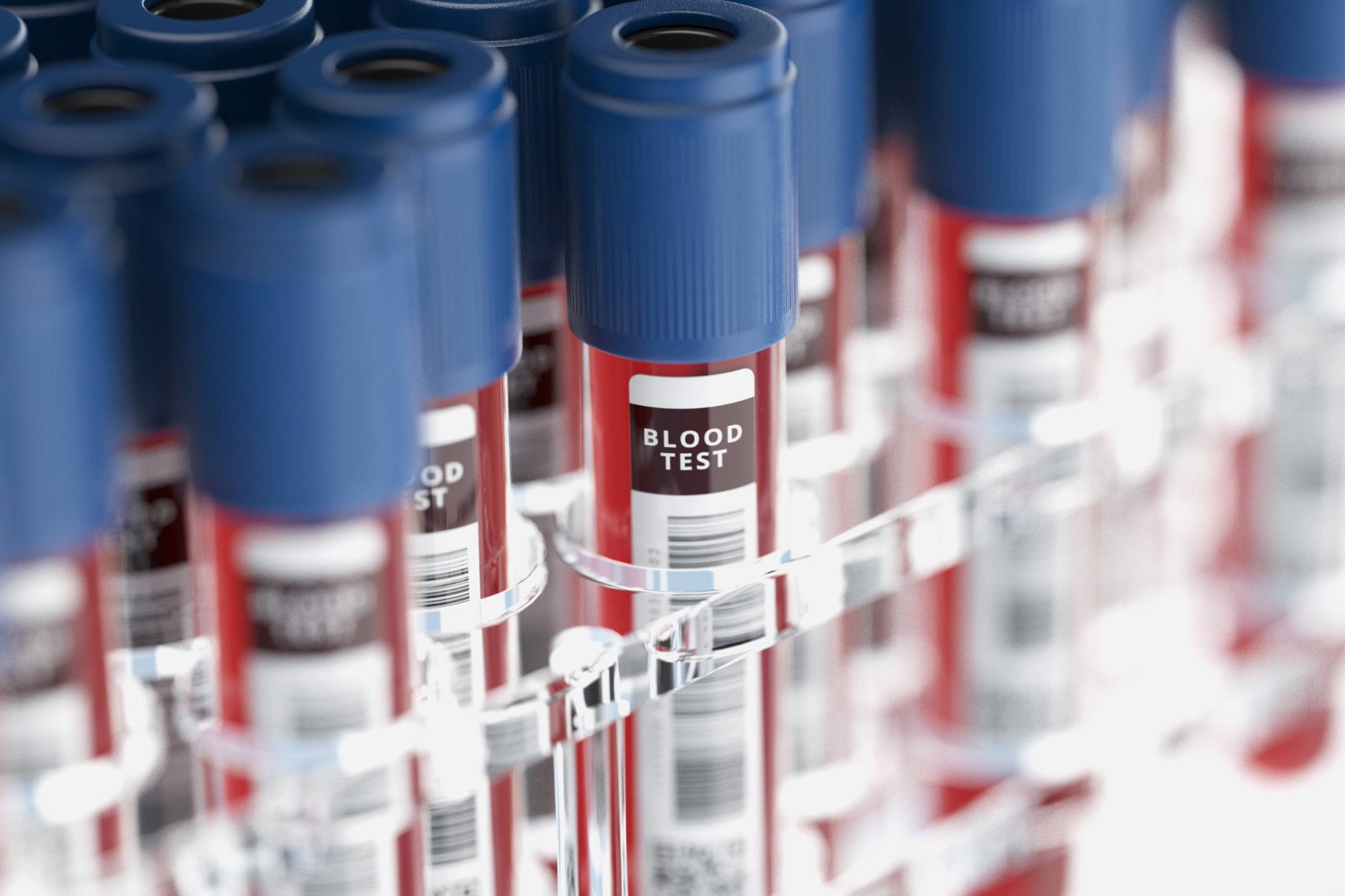 Prodrome | Blood Testing